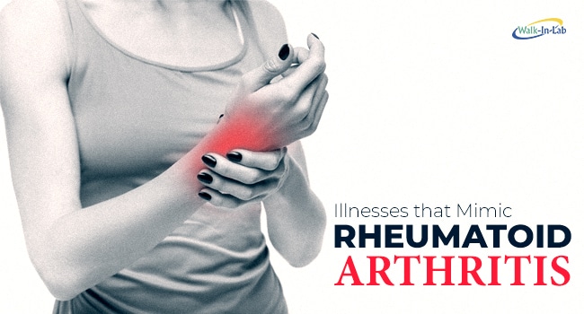 Illnesses that Mimic Rheumatoid Arthritis - Walk-In Lab Resource Center