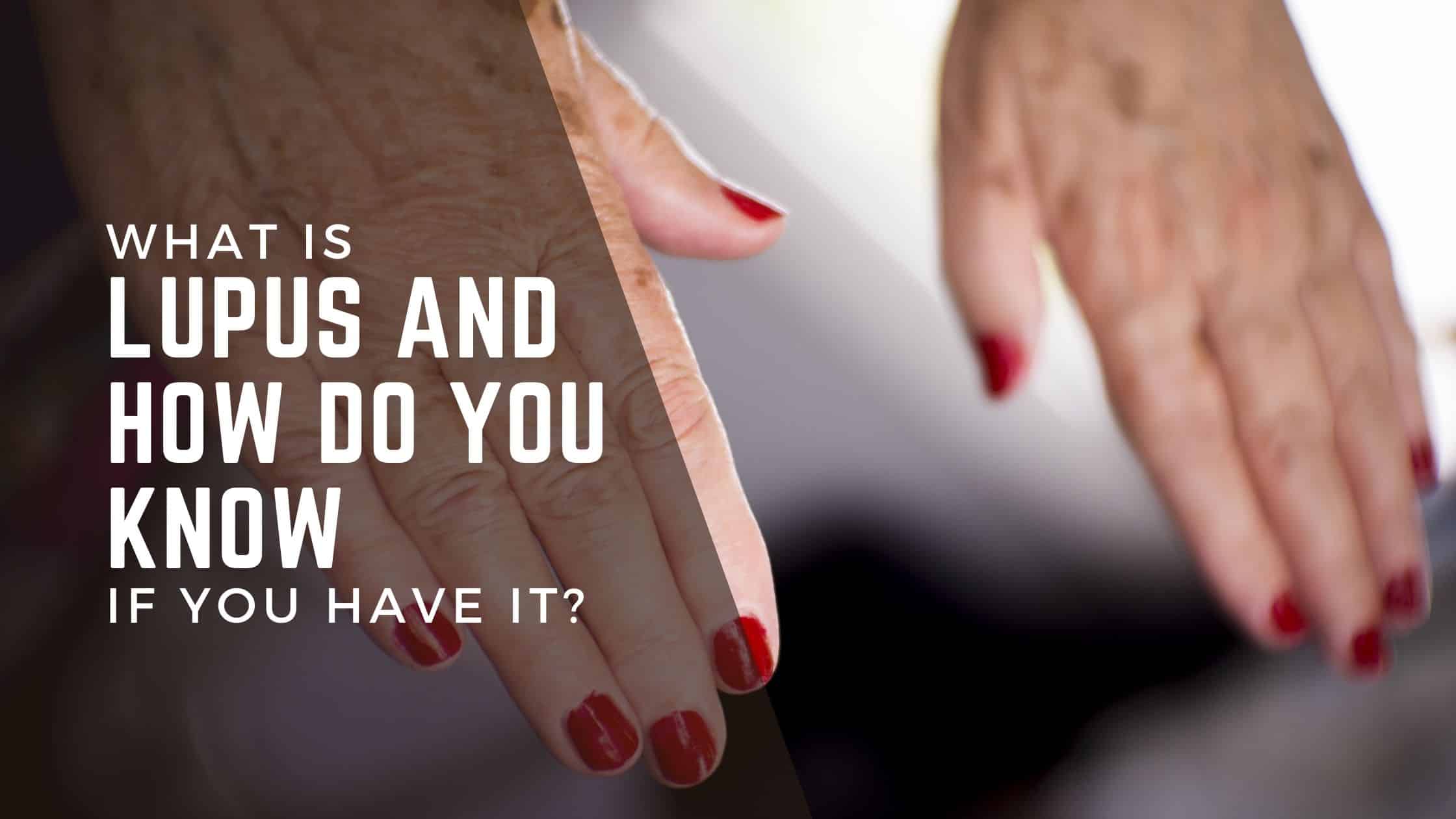 Lupus Symptoms and Diagnosis Explained