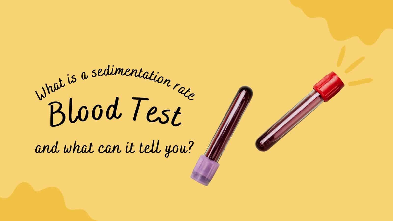 Sedimentation Rate Blood Test and What Can it Tell You ? | Walk-In Lab