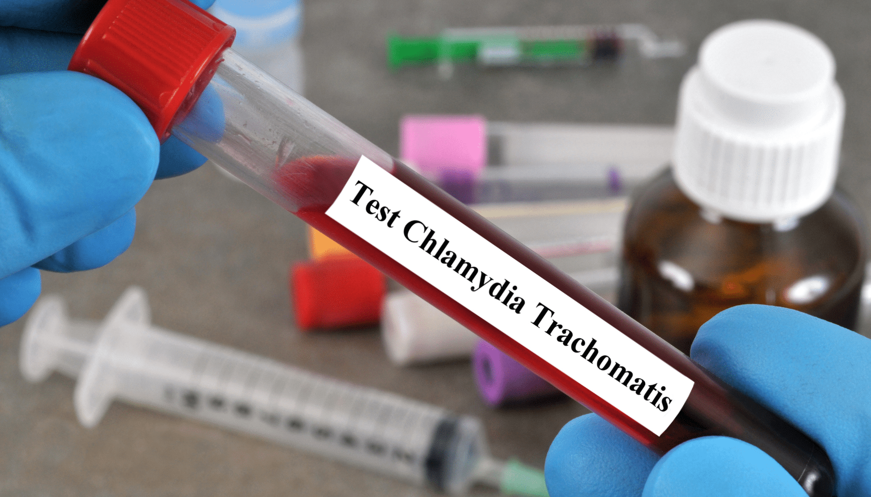 Chlamydia Testing Options: Types and Accuracy