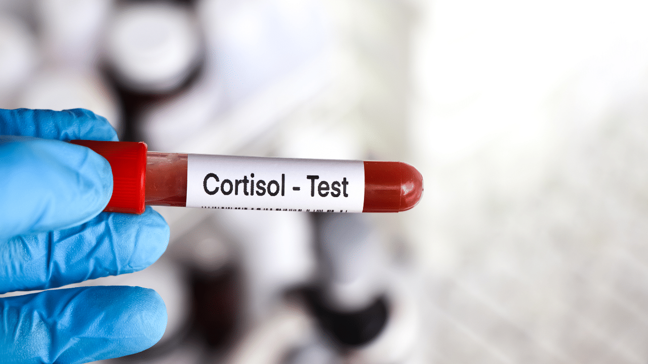 The Cortisol Blood Test: A Comprehensive Guide - Walk-In Lab Resource ...