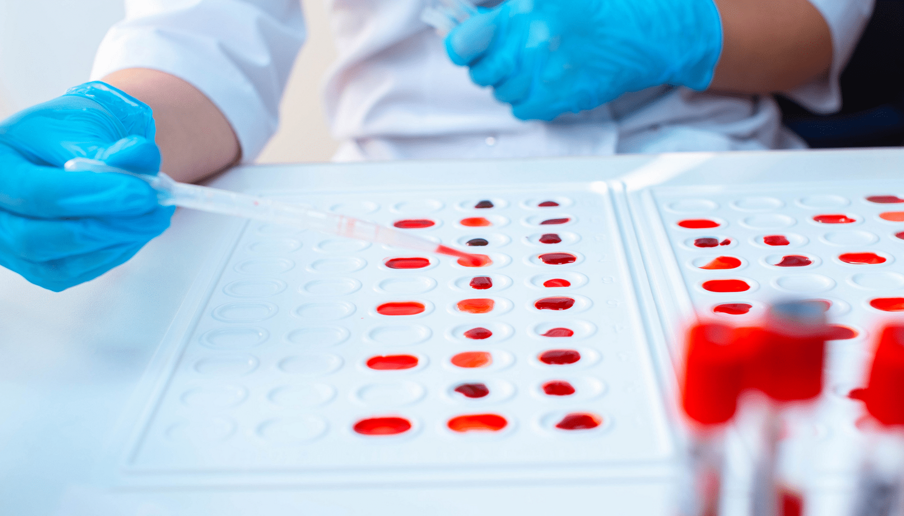 Types of Chlamydia Tests - Walk-In Lab Resource Center