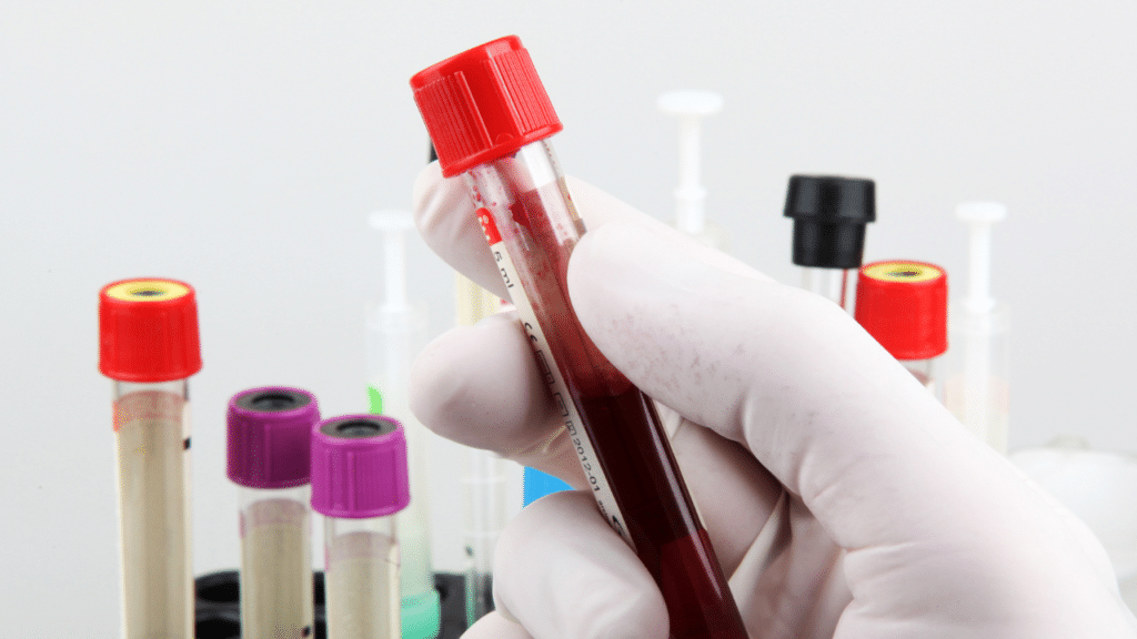 HHV-6 DNA PCR Blood Test Explained