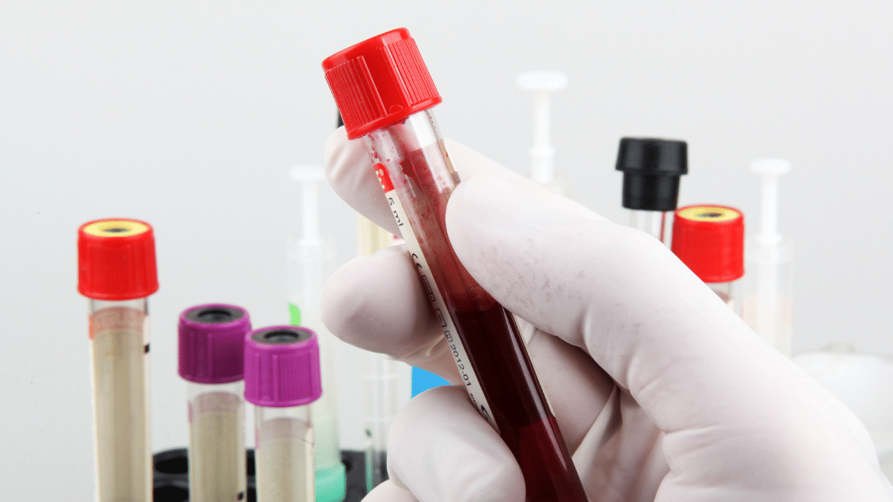HHV-6 DNA PCR Blood Test Explained