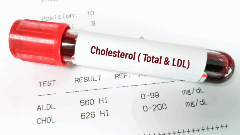 Complete Guide to Cholesterol Management
